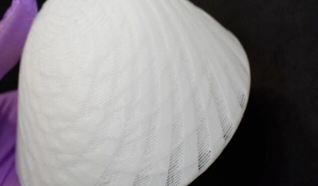 3D打印可吸收胸部和乳房植入物支架, BellaSeno开始人体医学试验 - 3D科学谷